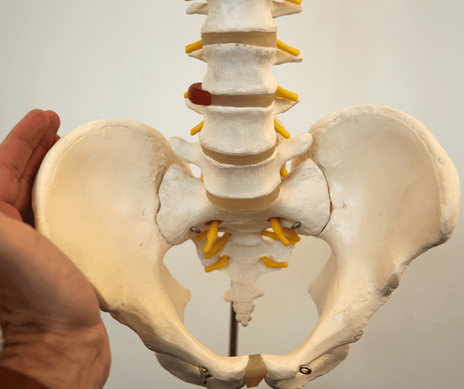 De oorzaken en behandelingen van Bekkenscheefstand - De Pijnvrij Methode®